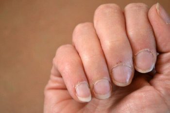 Easy DIY Cuticle Cream - Keeper of the Home